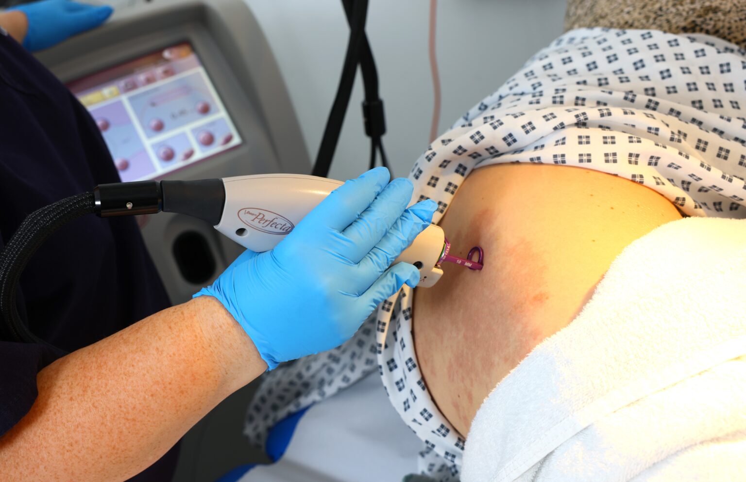 Laser treatments and prices - Newcastle Hospitals Private Healthcare